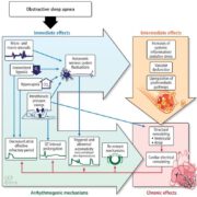 Síndrome de apnea obstructiva del sueño (SAOS) | Instituto ...
